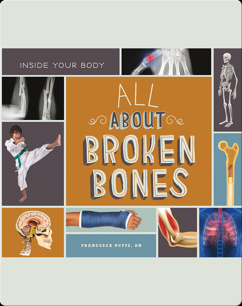 All About Broken Bones Book by Francesca Potts | Epic